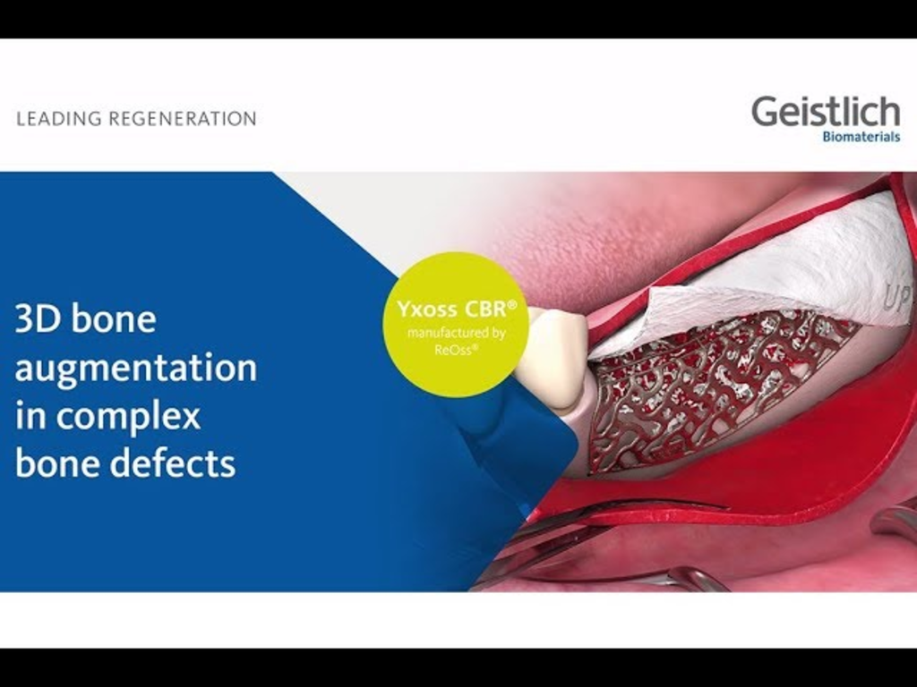 Geistlich USA: Yxoss CBR