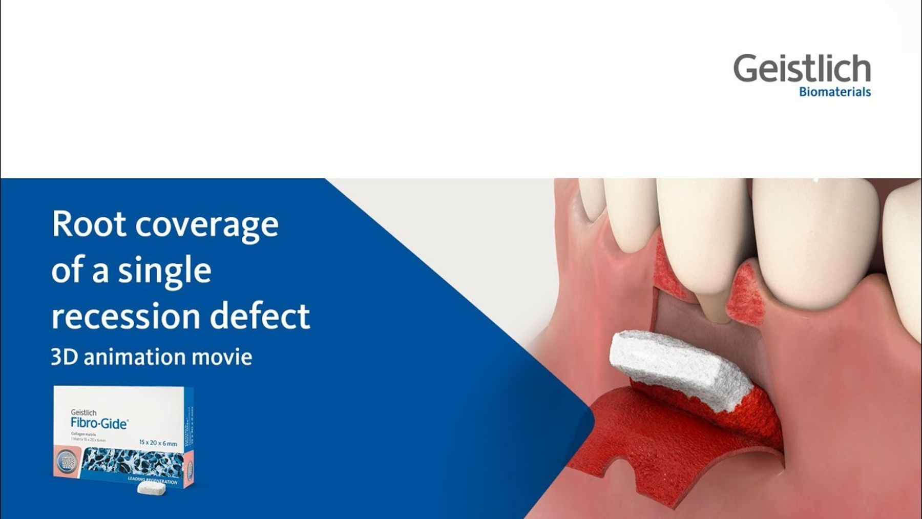 Geistlich USA: Downloads Dental Professionals