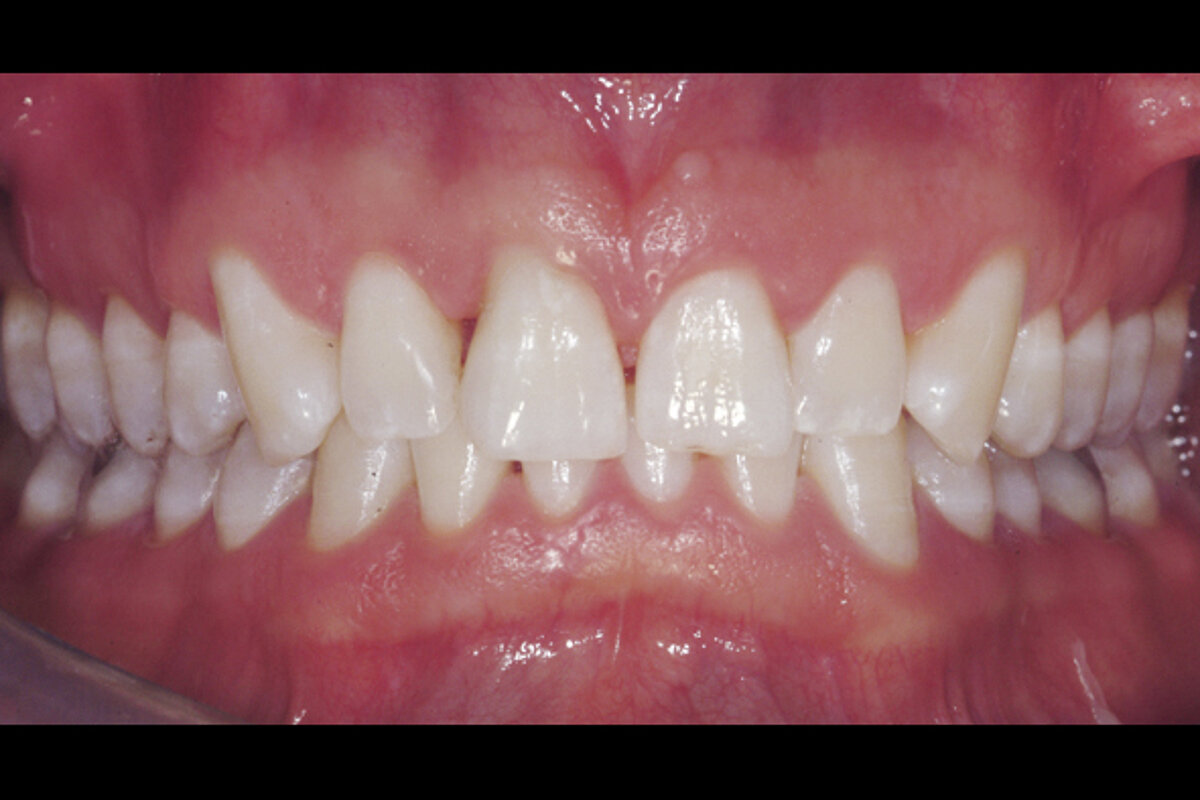 Geistlich USA: Periodontal Treatment