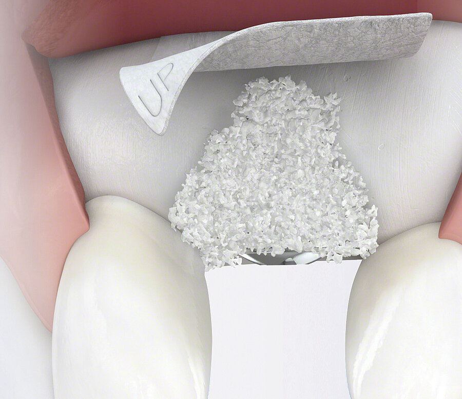 Geistlich USA: Geistlich Combi-Kit