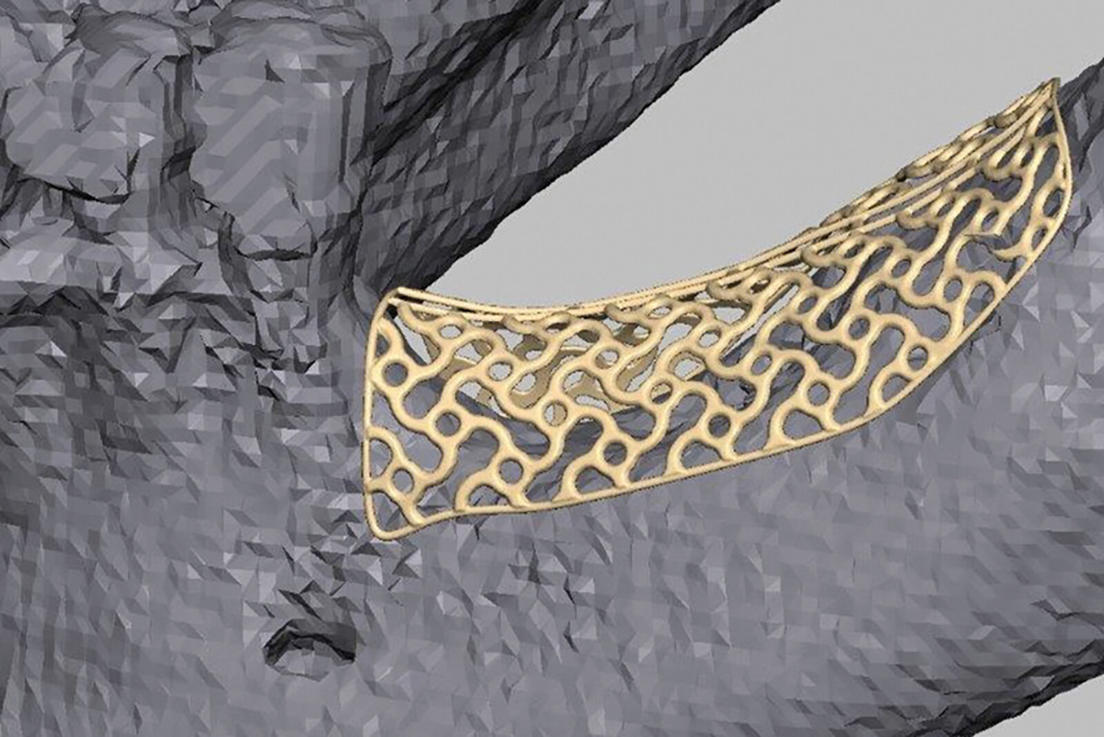 Geistlich USA: Yxoss CBR