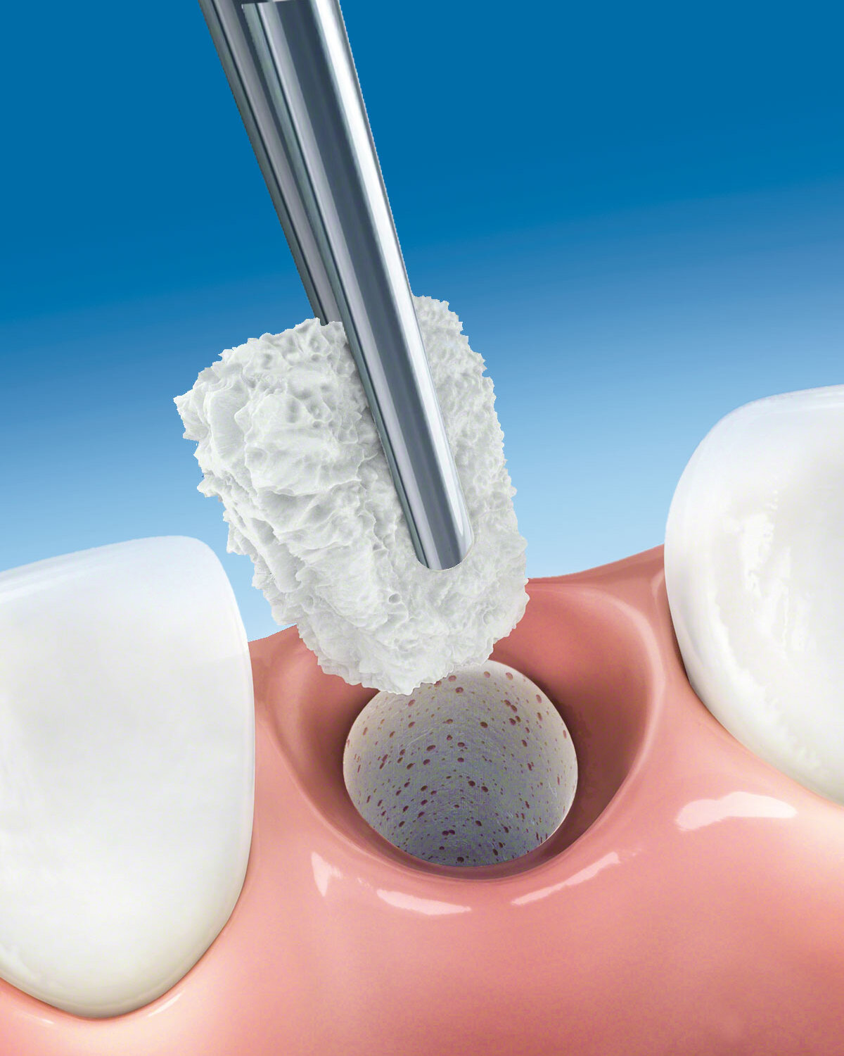 Geistlich USA: United States