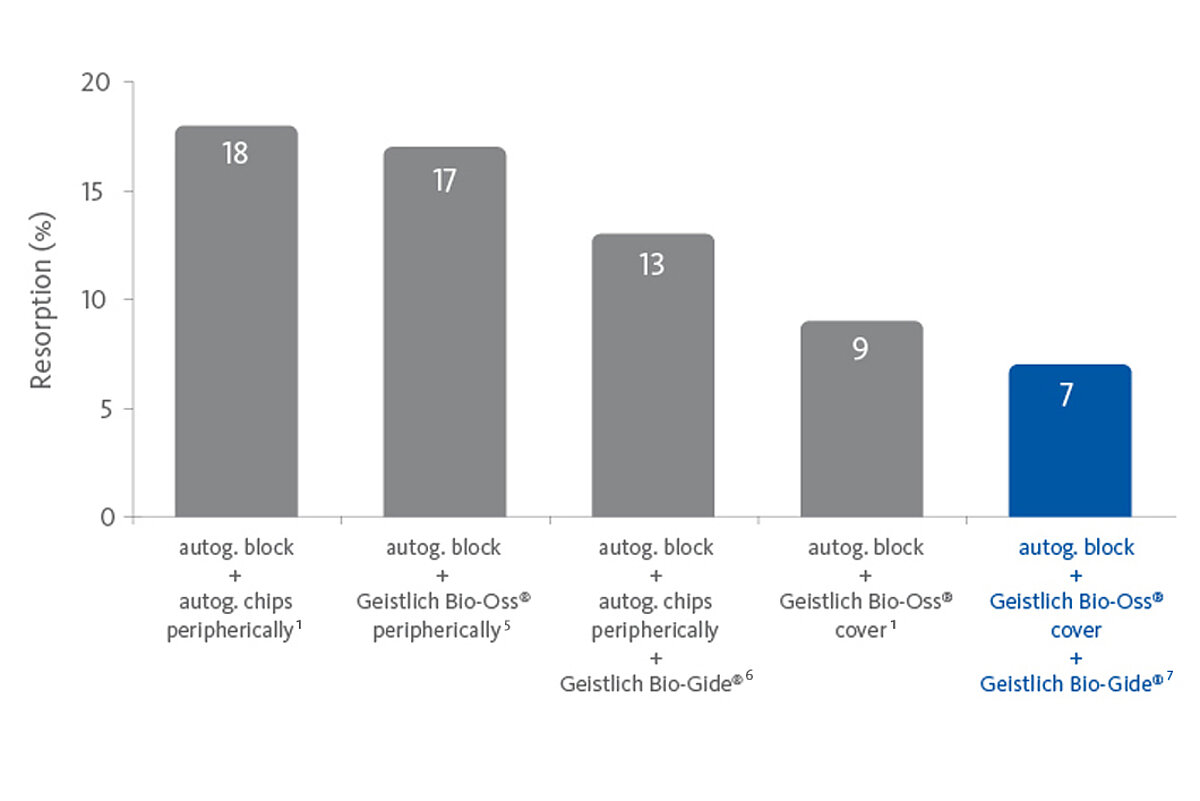 Geistlich USA: Major Bone Augmentation